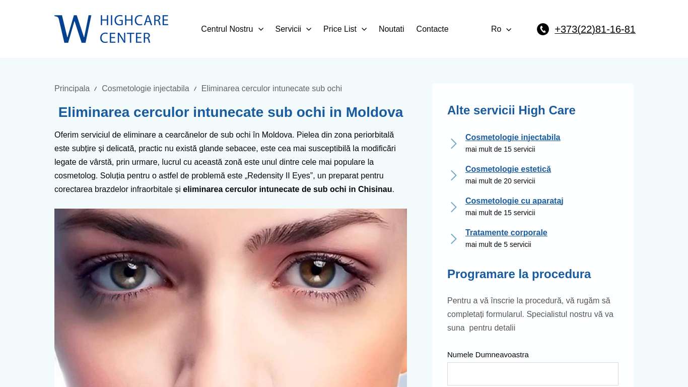 Eliminarea cerculor intunecate sub ochi in Moldova